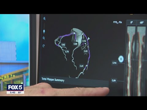 Using A.I. to detect heart disease