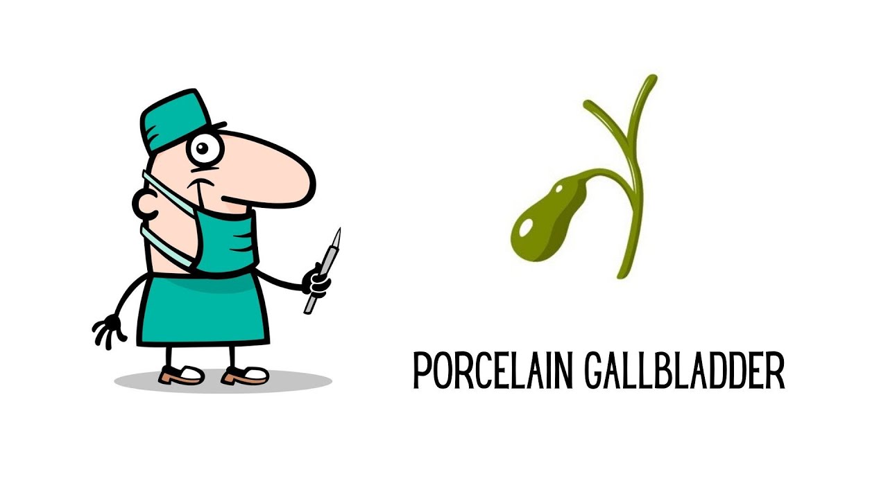 Porcelain Gallbladder
