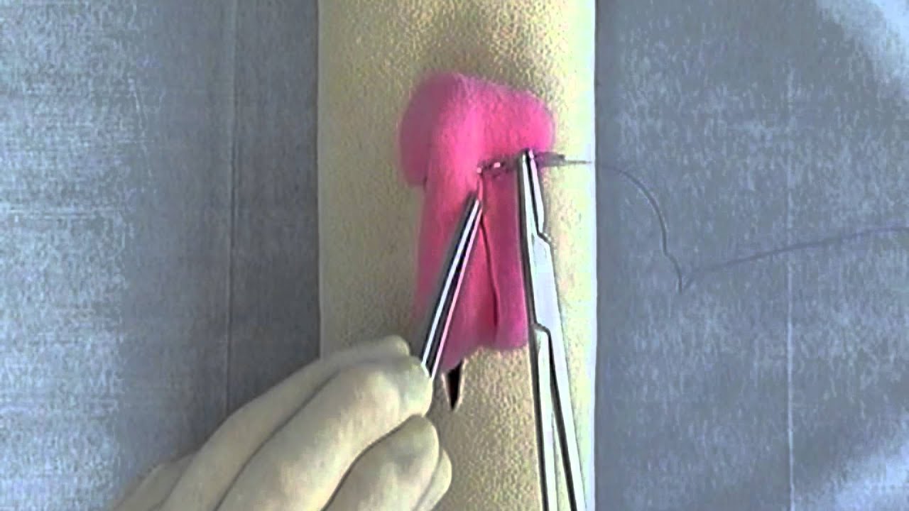 Lembert Suture Pattern