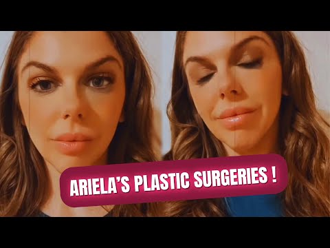 Ariela Weinberg Gets Mixed Reactions After Extreme Plastic Surgery Procedures