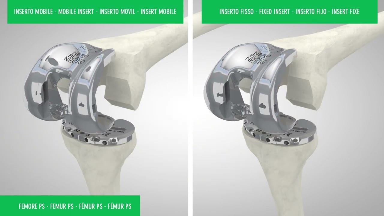 K MOD OPERATING TECHNIQUE 3REF