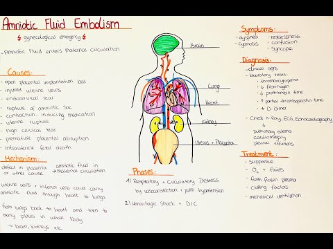 Amniotic Fluid Embolism - Causes, Symptoms, Diagnosis, Phases, Mechanism, Treatment