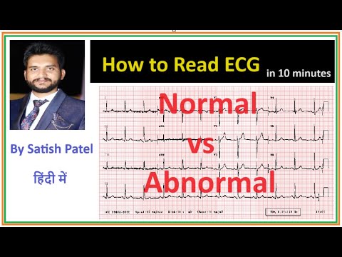 How to read an ECG, normal vs abnormal ECG@pna1 #satishpatel