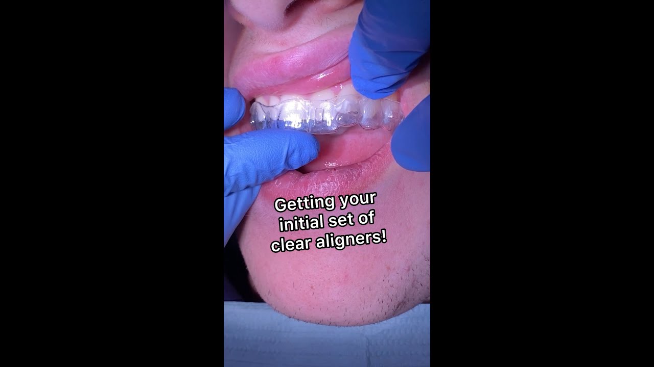 Getting your initial set of clear aligners / hybrid orthodontic / Tooth Time Family Dentistry NBTX