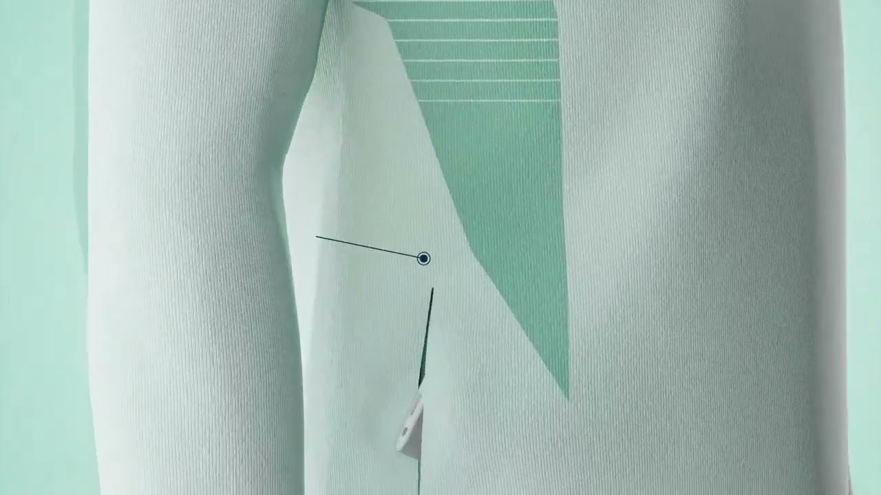 Sensor integration to garments by Softmatter