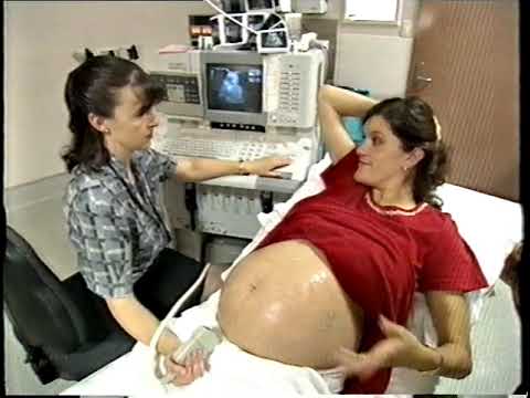 RPA TV Show 1996 Ep 3