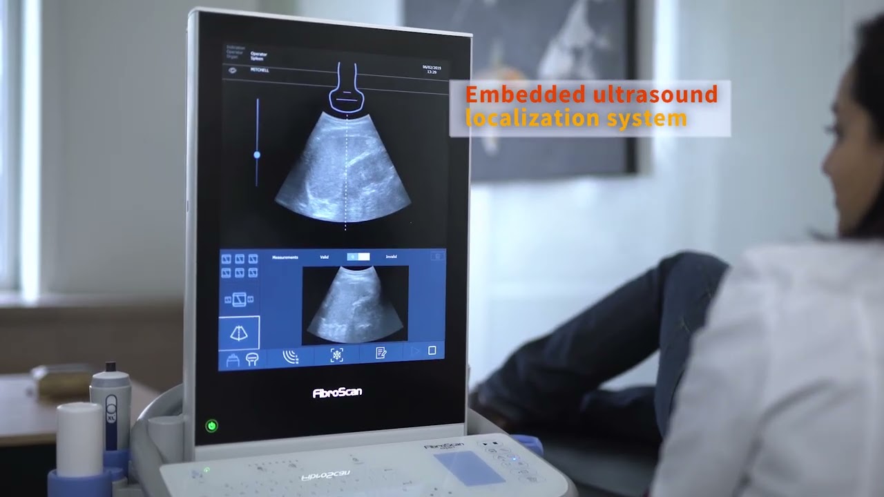 FibroScan® Expert 630  promotional video for download EN