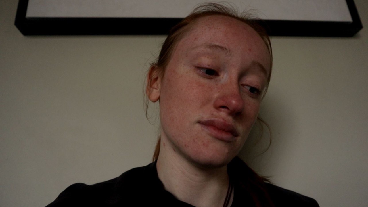 I was assaulted in a busy public park at 11am