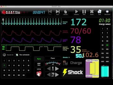 ECG Simulator - Electrocardiogram Simulator Latest Price, Manufacturers ...
