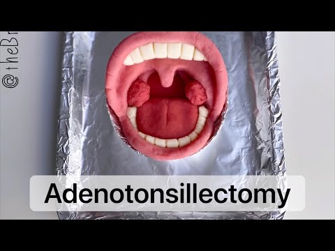 Playdough Surgery - Tonsillectomy and Adenoidectomy