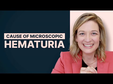 Determining The CAUSE OF MICROSCOPIC HEMATURIA