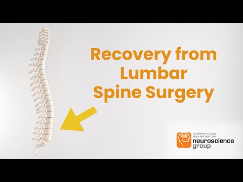 What to Expect After Your Lumbar Spine Surgery