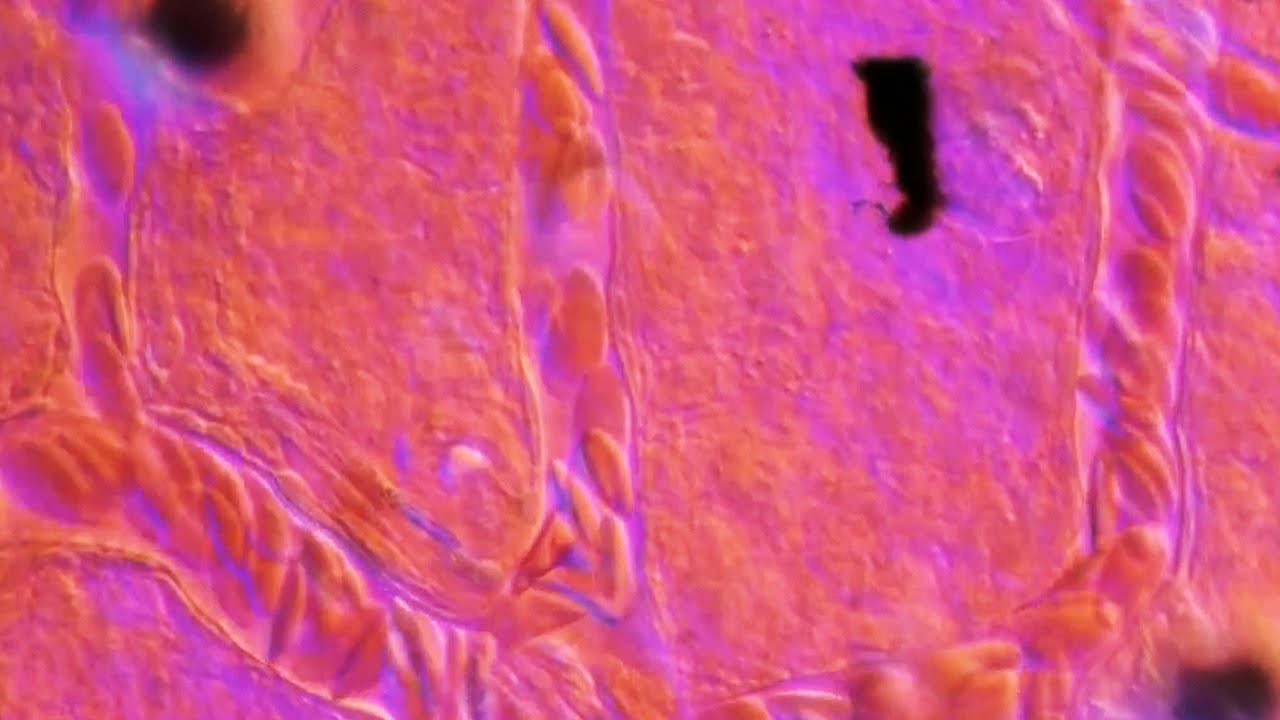 Capillary Blood Flow in Frog Web