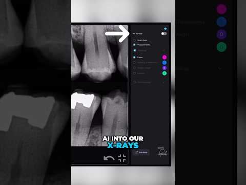 How AI is used in Dentistry π€π¦· #AI #dentist