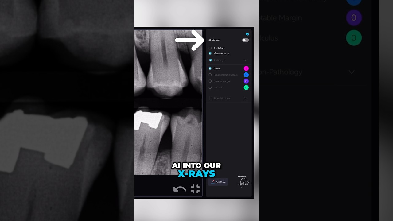 How AI is used in Dentistry 🤖🦷 #AI #dentist