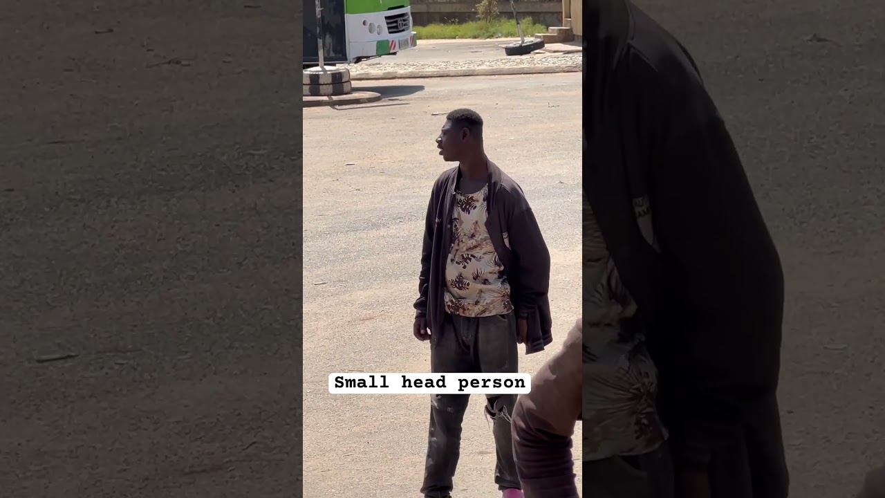 #ethiopian #smallhead person