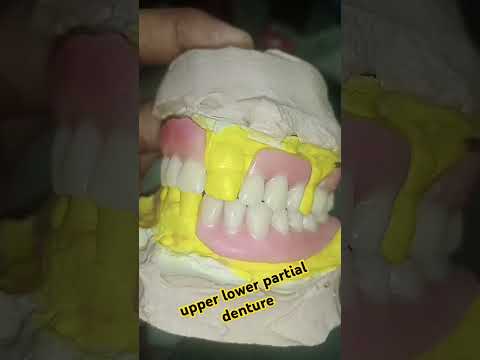 upper lower partial denture 😁😁😁#dentist #artificialteeth #splittooth #teethwhiting #partialdenture