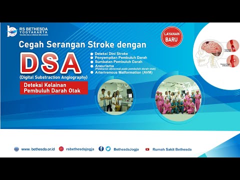 TEROPONG PEMBULUH DARAH OTAK, PASANG RING & BALON OTAK PADA PASIEN STROKE - Bethesda Talk Show Ep 40