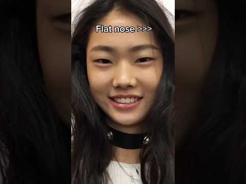 Small Nose vs Flat Nose Embracing Different Facial Features#viral #skincare #medical #nose