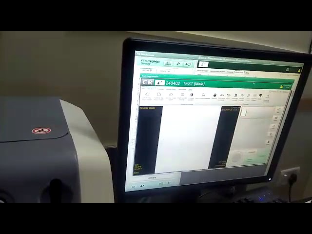 Computed Radiography System - Digiray Firecr Spark Cr System Trader ...