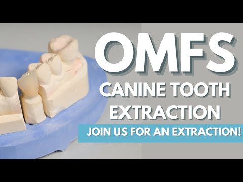 Canine Tooth Extraction with Oral and Maxillofacial Surgery of Chicago | REAL SURGICAL CONTENT