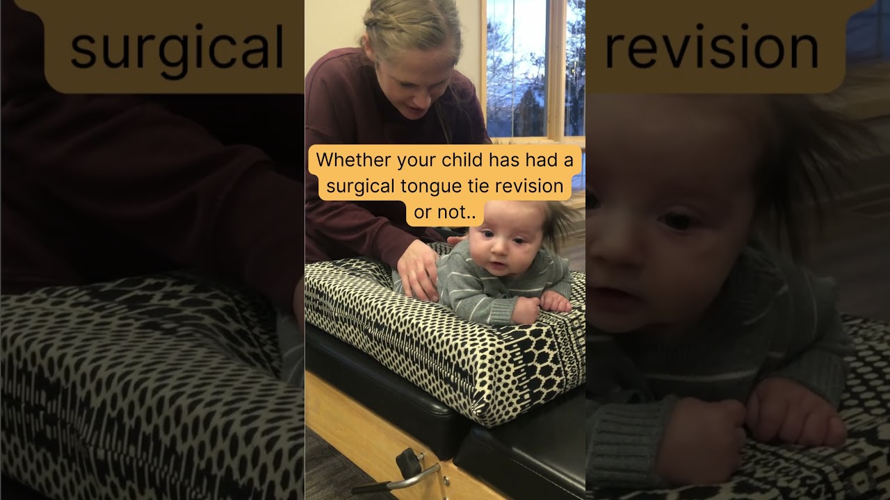 Tongue ties 👅 are a hot topic in the health world today.