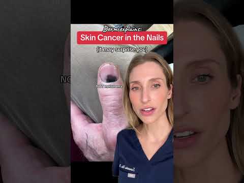Did you see the difference? #nails