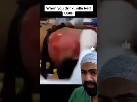 Surgeon Reacts To Crazy Trauma Injury!