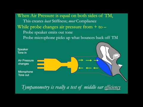 The Tympanogram