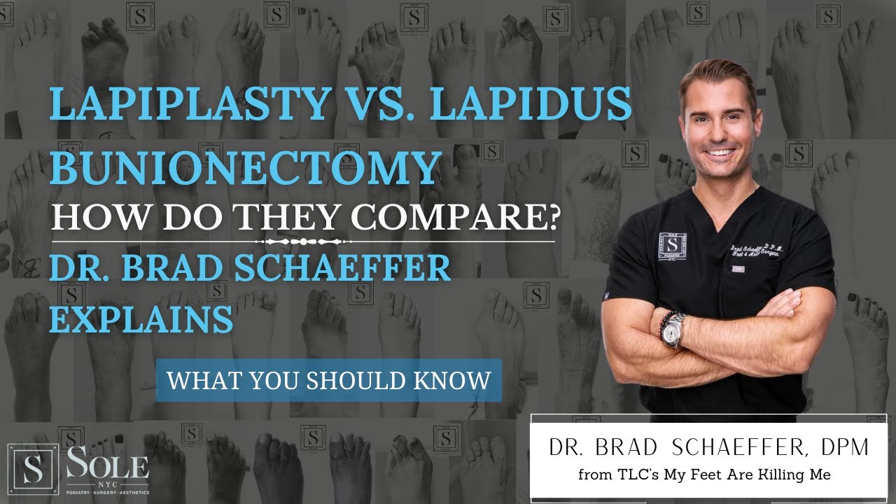 Lapiplasty Vs. Lapidus Bunionectomy: Which One Is Better? | Central ...