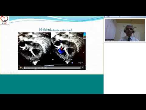 Pedicardio classes on Pulmonary circulation by Dr Suresh Kumar