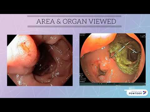 Duodenoscope/ERCP - Basic learning