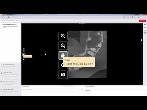 3D Endo - Manipulate Views - #4 | Dentsply Sirona