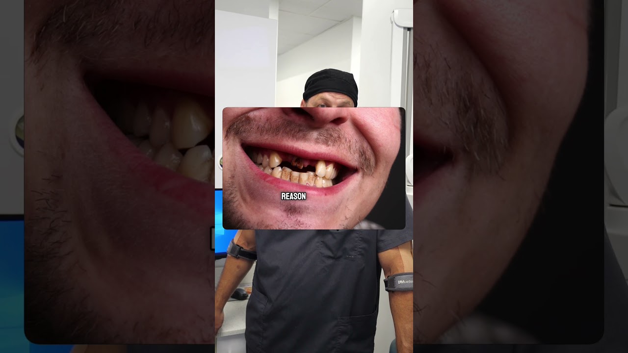 Understanding Dental Implant Risks: What You Need to Know