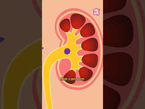 What Causes Kidney Stones? | World Kidney Day Special #shorts #kidneystone #worldkidneyday
