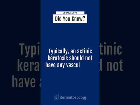 Dermoscopy - Did You Know?