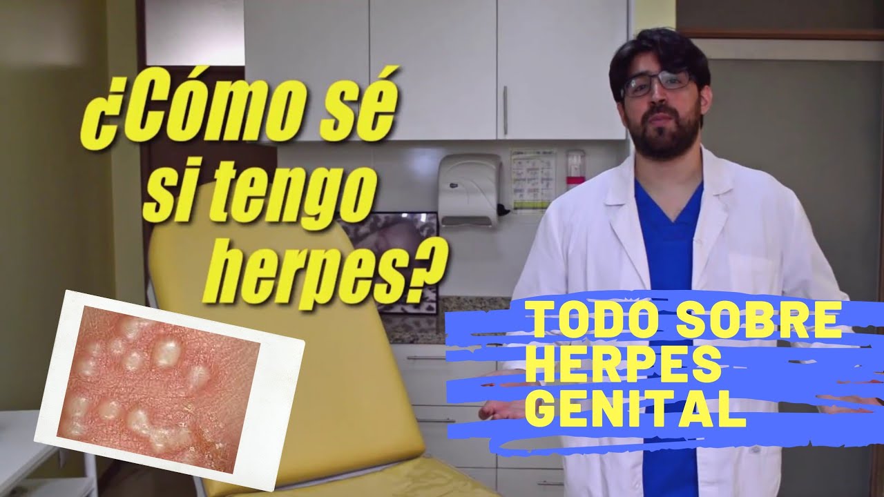 Herpes Genital ¿Tiene Cura? | Dr Ego