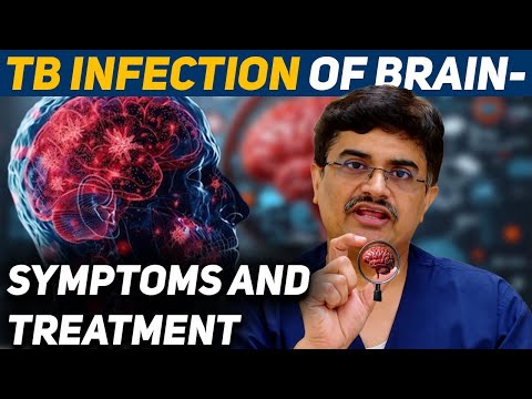 TB Infection of Brain- Symptoms and Treatment Dr.Roopesh Kumar