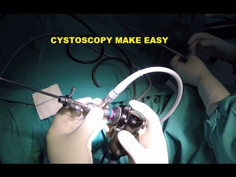 Cystoscope - Cystoscopy Set Latest Price, Manufacturers & Suppliers