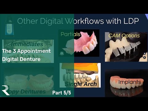 The 3 Appointment Digital Denture Webinar (part 5 of 5)