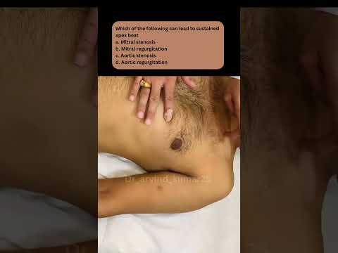 Clinical examination- CVS #cvs #healthcareprofessionals #doctors