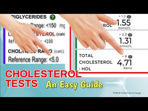 Cholesterol Tests Easy Guide