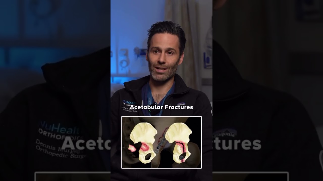 When asking our doctors at Total Orthopedics to translate basic basic medical terms…🗣️👨‍⚕️ You
