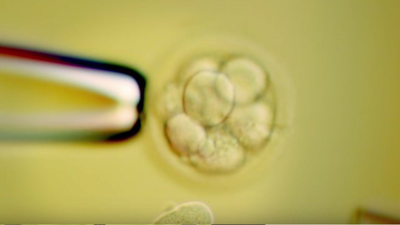 Are Cosmetically Engineered Babies Changing The Course Of Evolution? | BBC Earth Science