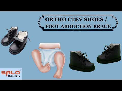 Clubfoot Treatment By Shoes |CTEV Shoes |Dennis Brown Splints |DB Splints |Ortho Shoes |Walking Shoe
