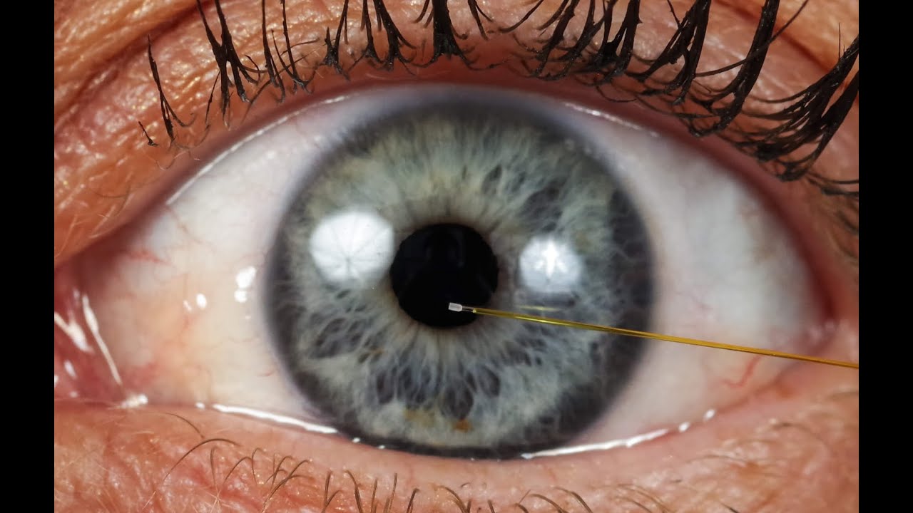 Benefits of Fiber Optic Sensors