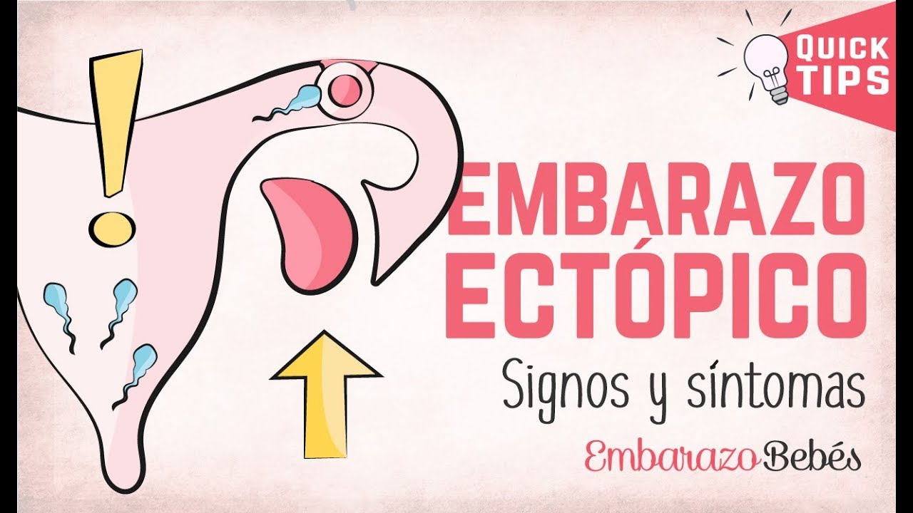 ¿Cómo saber si tengo un embarazo ectópico? | Padres