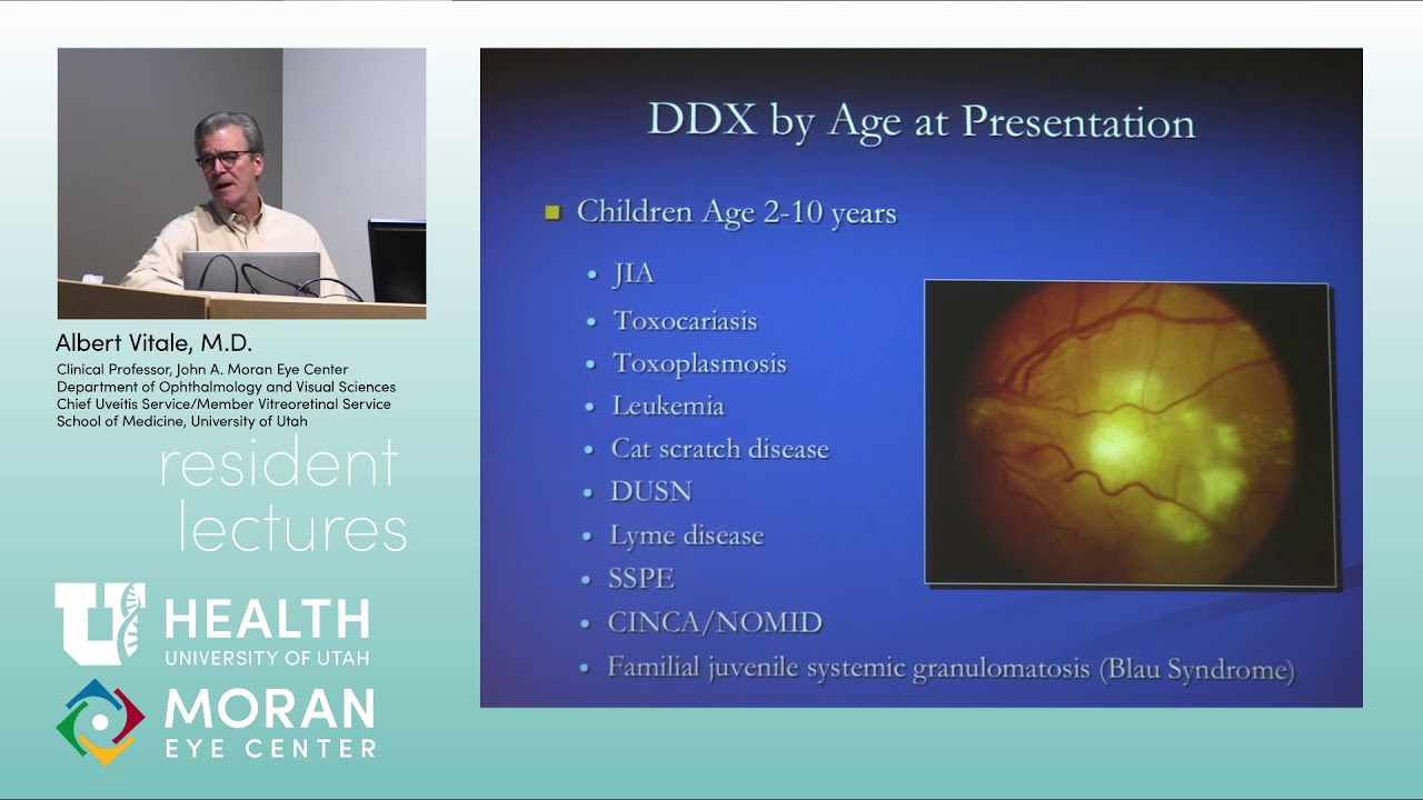 Pediatric Uveitis [ARCHIVE]