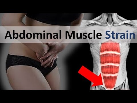 Abdominal Muscle Strain.