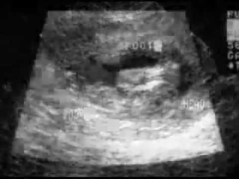 Truth & Mercy Pro-Life Ministries